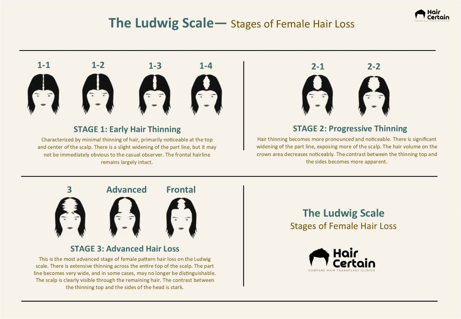 Ultimate Guide to Hair Transplant costs in Canada – Hair Transplants in ...